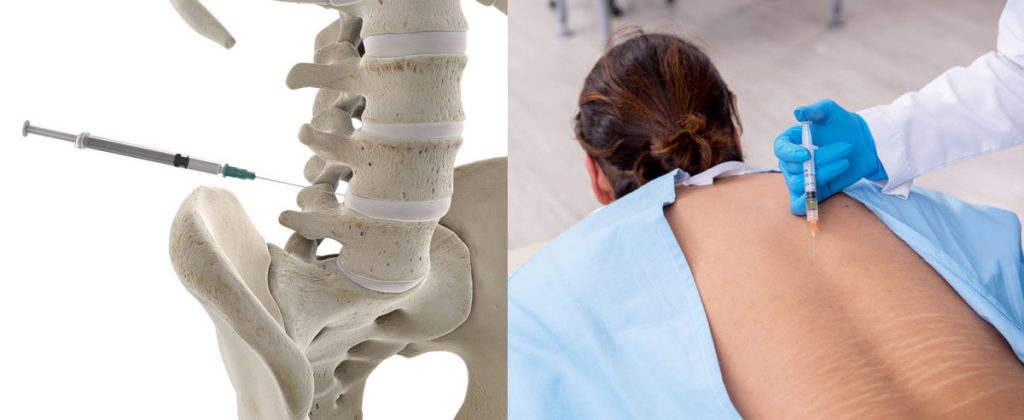 Spinal Injections for neck and back pain relief treatment – D Spine
