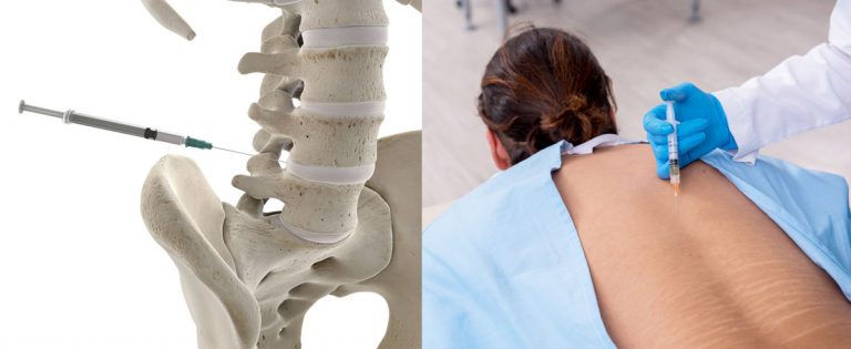 Spinal Injections for neck and back pain relief treatment – D Spine